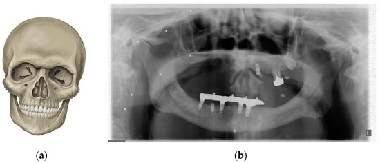 Basic Knowledge and New Advances in Panoramic Radiography Imaging ...