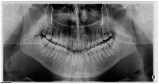Basic Knowledge and New Advances in Panoramic Radiography Imaging ...