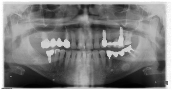 Basic Knowledge and New Advances in Panoramic Radiography Imaging ...
