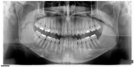 Basic Knowledge and New Advances in Panoramic Radiography Imaging ...