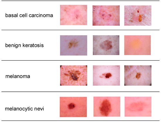 A Study on Multiple Factors Affecting the Accuracy of Multiclass Skin ...
