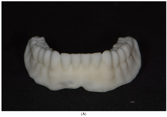 Digital Denture Fabrication: A Technical Note