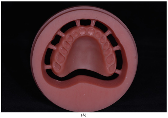 Digital Denture Fabrication: A Technical Note