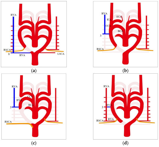 Applied Sciences | Free Full-Text | Anomalous Origin of the Right ...