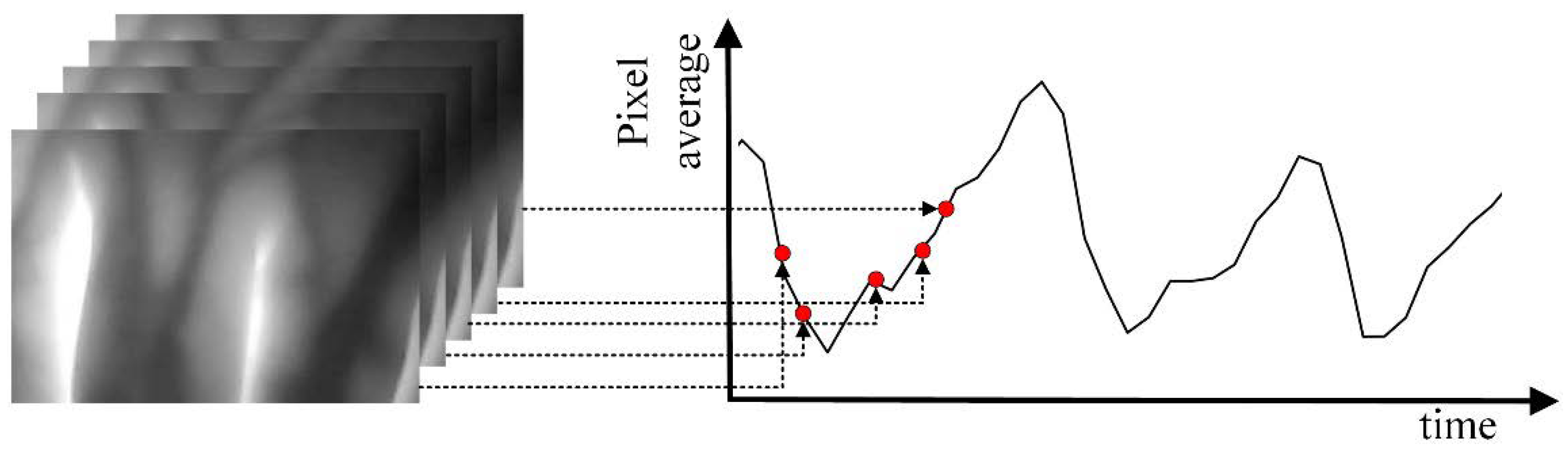 Applied Sciences | Free Full-Text | Non-Contact Heart Rate Detection Based on Hand Vein ...