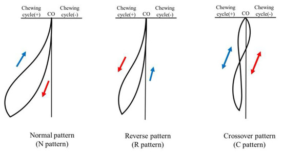 Applied Sciences | Free Full-Text | The Effects of Chewing Exercises on ...