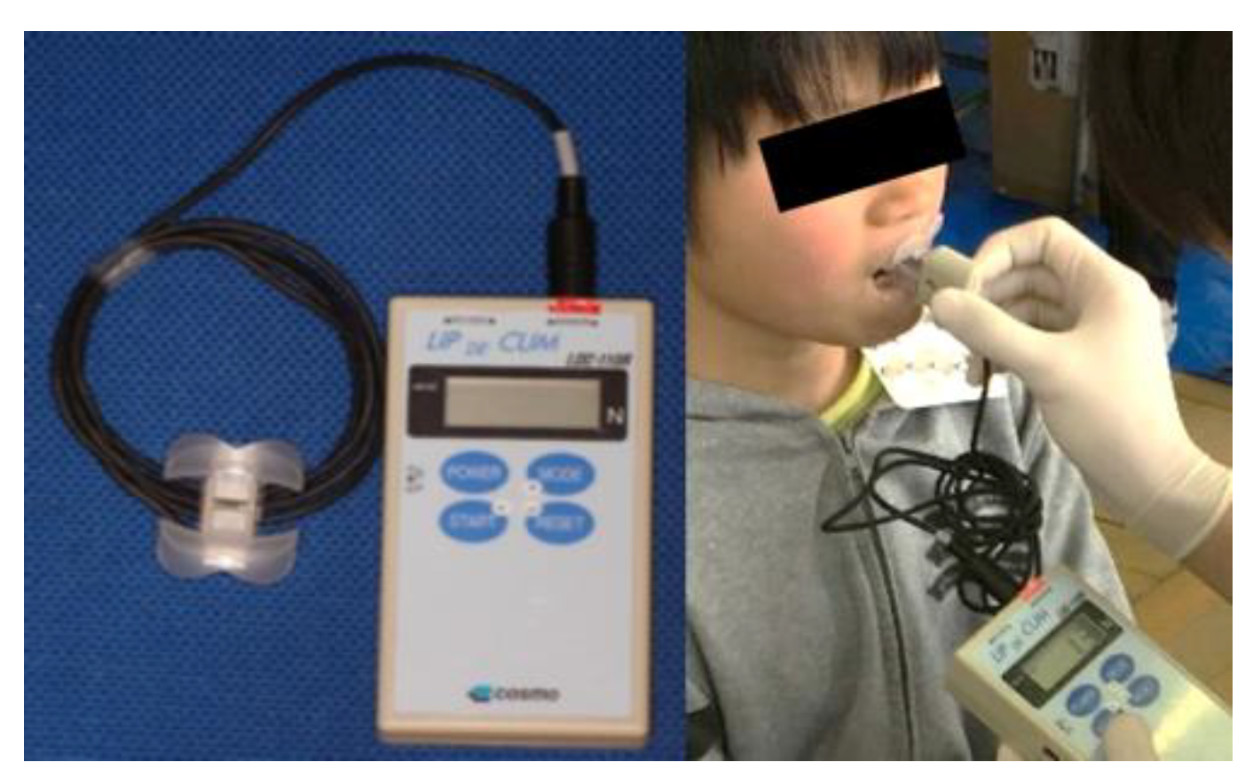 The Effects of Chewing Exercises on Masticatory Function after Surgical ...