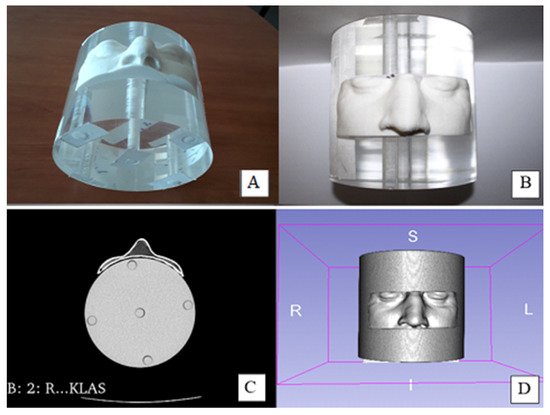 Development of Patient Specific Conformal 3D-Printed Devices for Dose ...