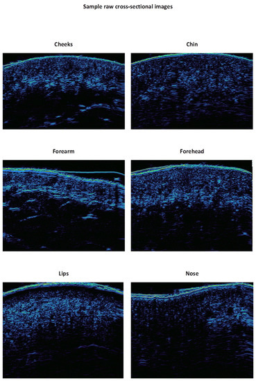 Skin Characterizations by Using Contact Capacitive Imaging and High ...