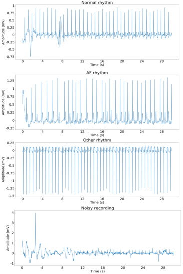Applied Sciences | Special Issue : Advances in Biosignal Processing and ...