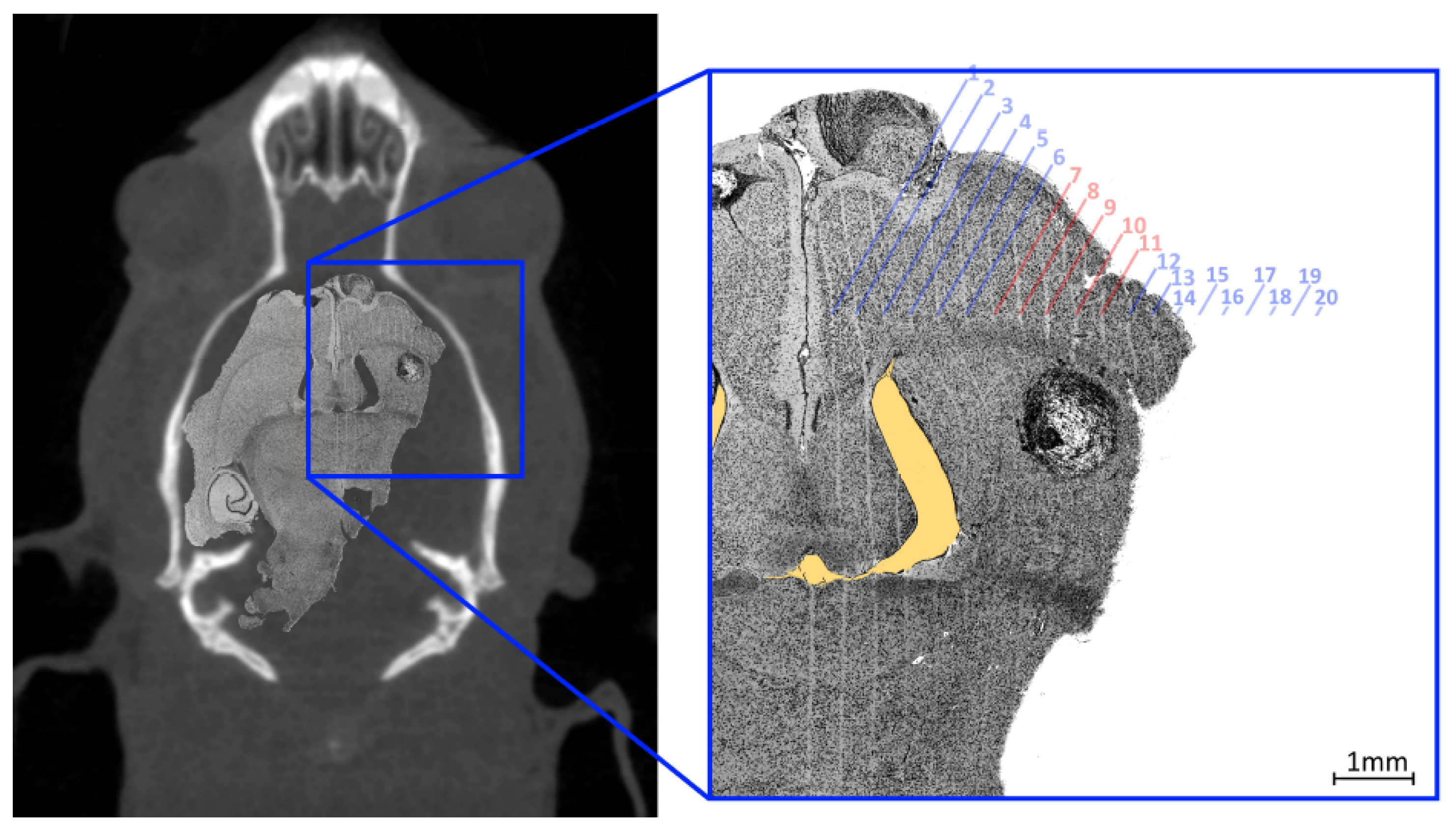 Incorporating Clinical Imaging into the Delivery of Microbeam Radiation ...