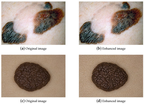 Dermoscopy Images Enhancement via Multi-Scale Morphological Operations