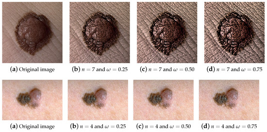 Applied Sciences | Free Full-Text | Dermoscopy Images Enhancement via Multi-Scale Morphological ...