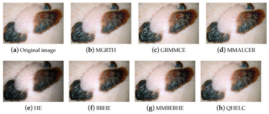 Applied Sciences | Free Full-Text | Dermoscopy Images Enhancement via Multi-Scale Morphological ...