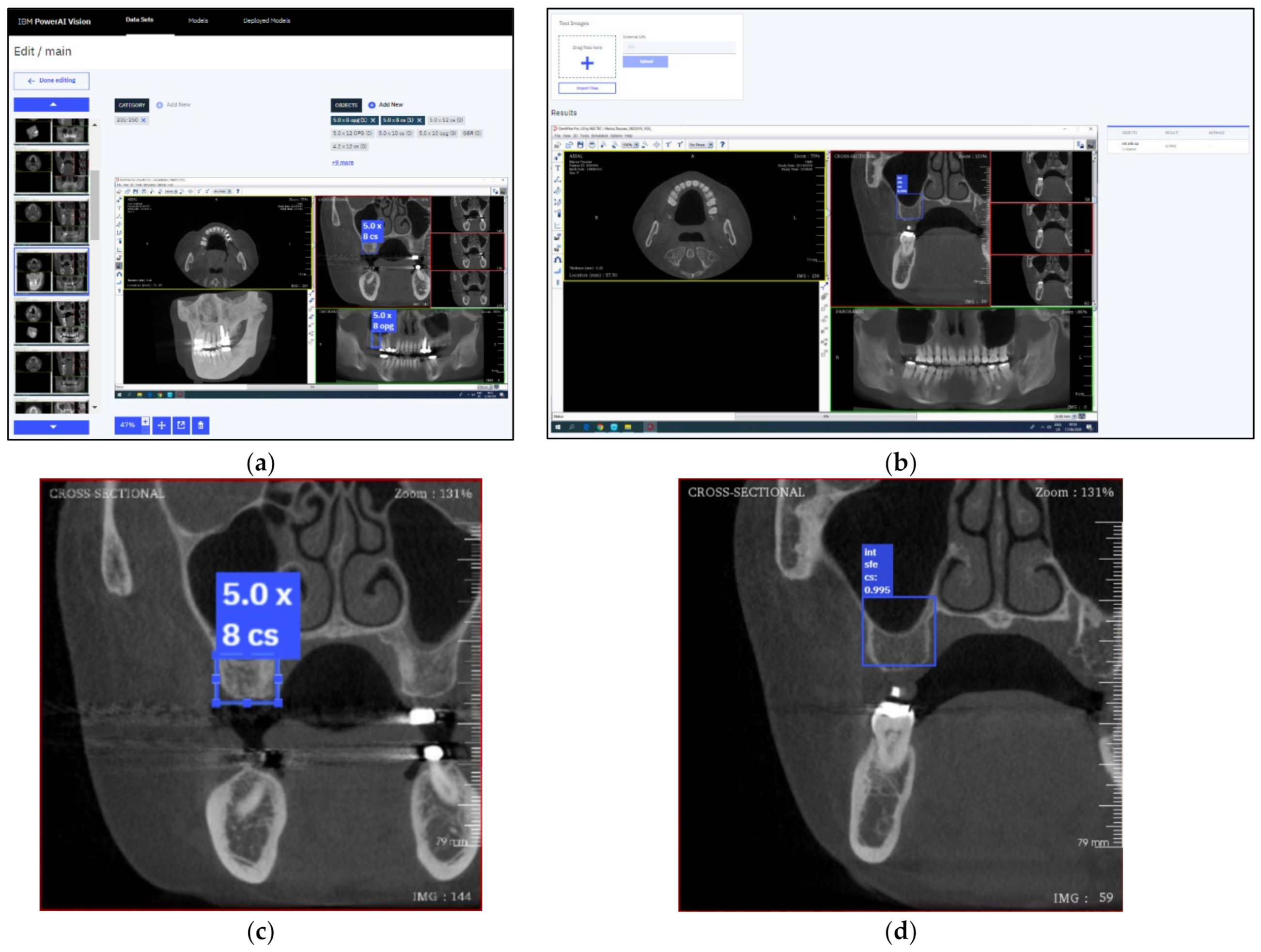 The Learning Curve of Artificial Intelligence for Dental Implant ...