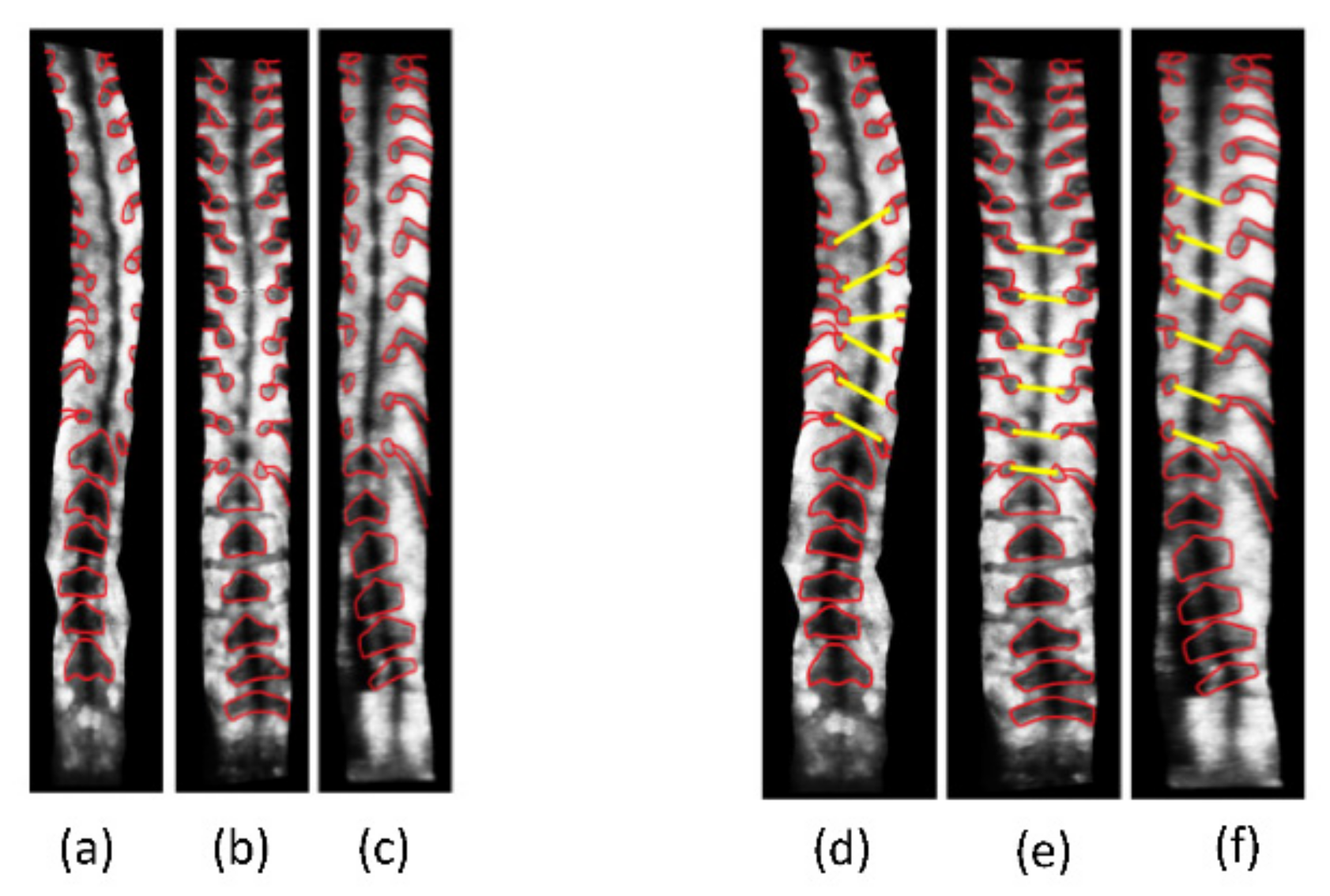 Applied Sciences | Free Full-Text | Light-Convolution Dense Selection U ...