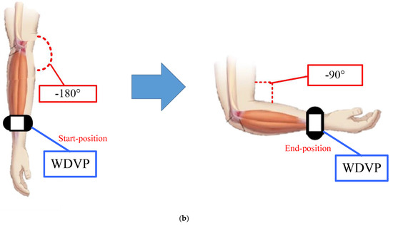 Wearable Device for Residential Elbow Joint Rehabilitation with Voice ...