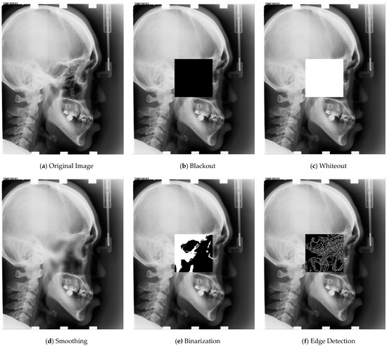 Accurate Landmark Localization for Medical Images Using Perturbations