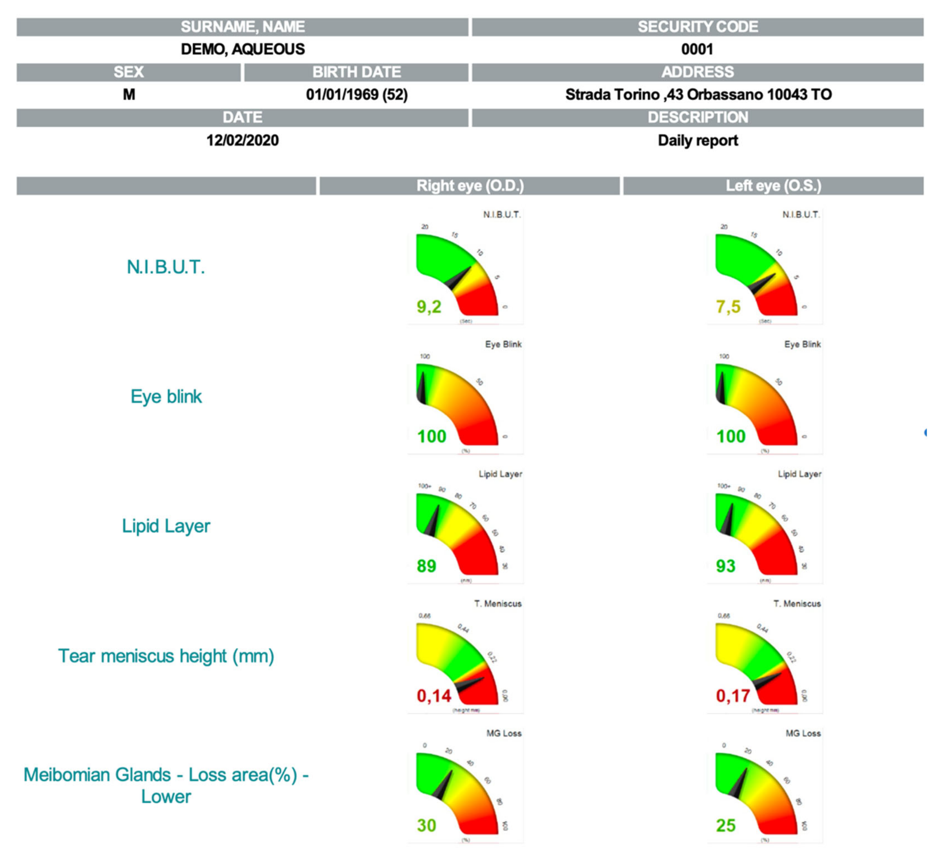 Advances in the Noninvasive Diagnosis of Dry Eye Disease