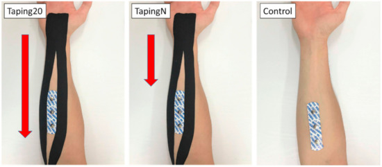 Effect of Kinesio Taping on Hand Sensorimotor Control and Brain Activity