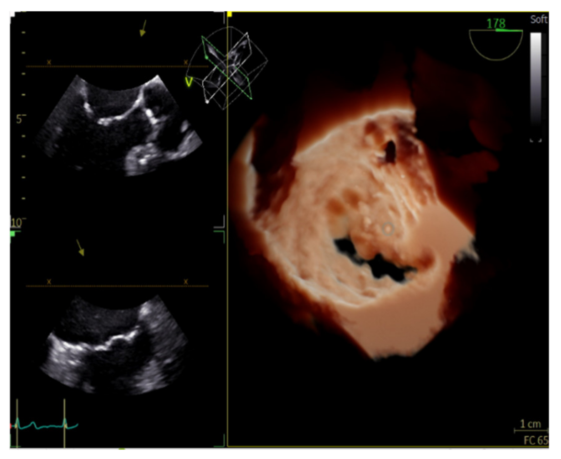 Applied Sciences | Free Full-Text | Imaging Techniques for Cardiac Function