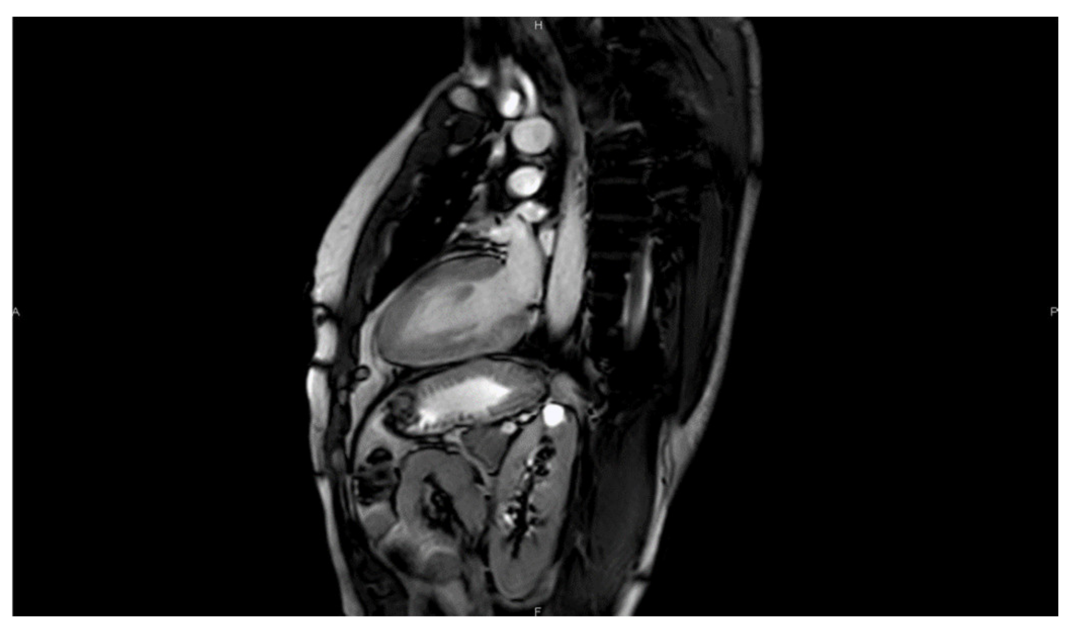 Applied Sciences | Free Full-Text | Imaging Techniques for Cardiac Function