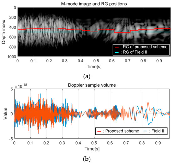 Image-Free Ultrasound Blood-Flow Monitoring Circuit System with ...