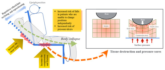 Analysis of Body-Slip and Buttock Pressure Characteristics during ...