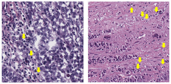 Deep Learning Approaches to Colorectal Cancer Diagnosis: A Review