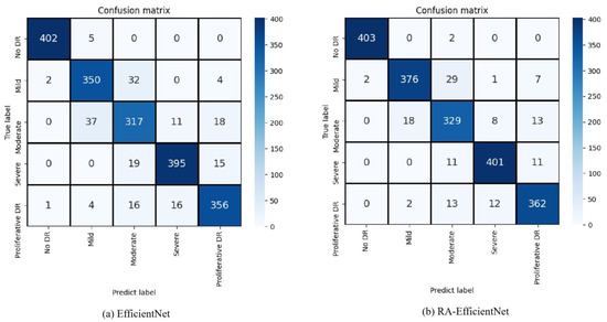 Diabetic Retinopathy Diagnosis Based on RA-EfficientNet
