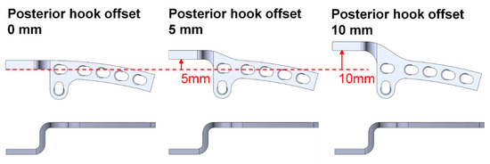 Biomechanical Analysis of Clavicle Hook Plates with a Range of ...