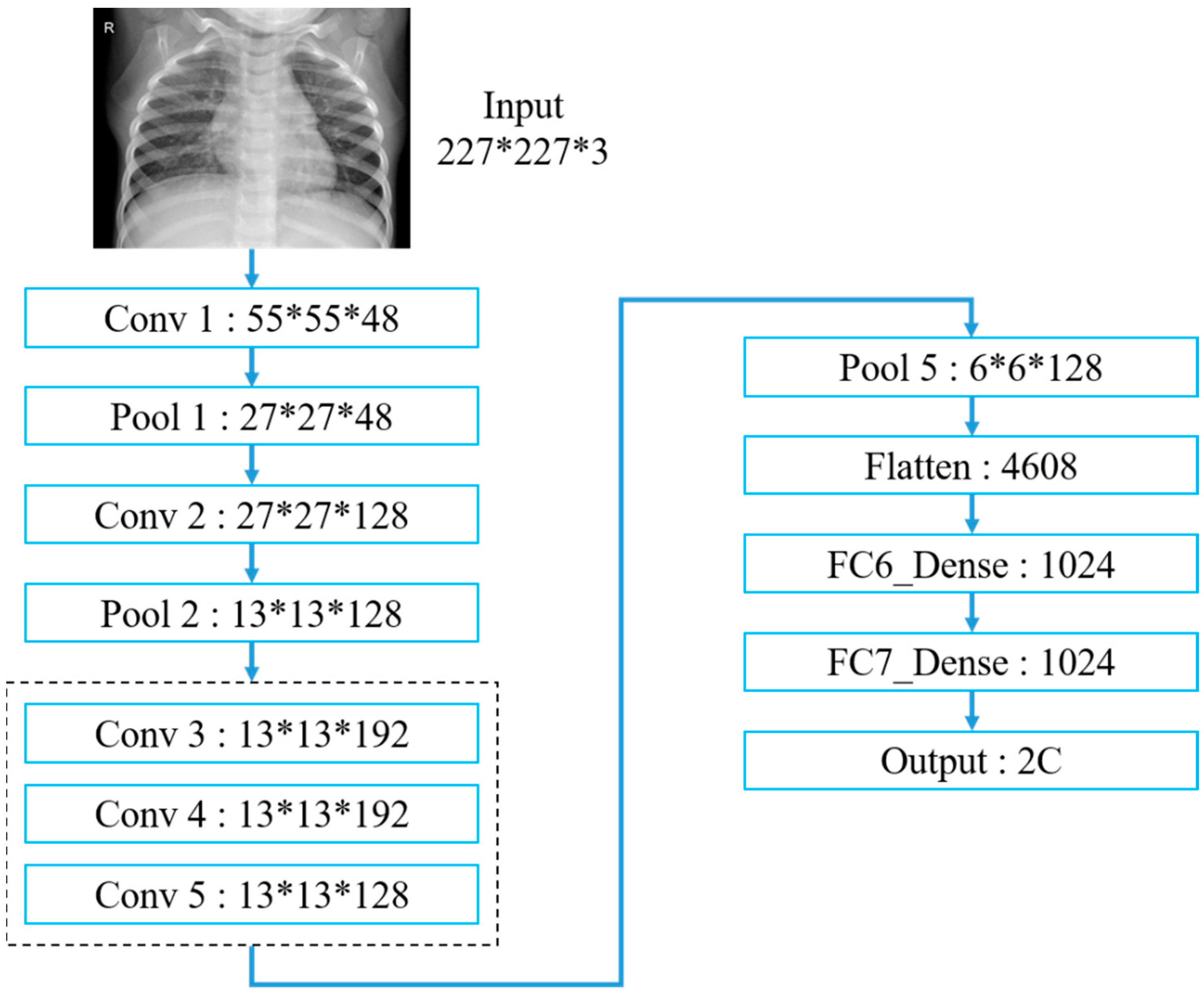 An Improved VGG16 Model for Pneumonia Image Classification