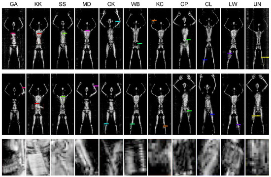 A Hard Example Mining Approach for Concealed Multi-Object Detection of Active Terahertz Image