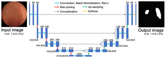 Automated Detection of Gastric Cancer by Retrospective Endoscopic Image ...