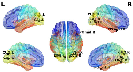 Altered Dynamic Functional Connectivity of Cuneus in Schizophrenia ...