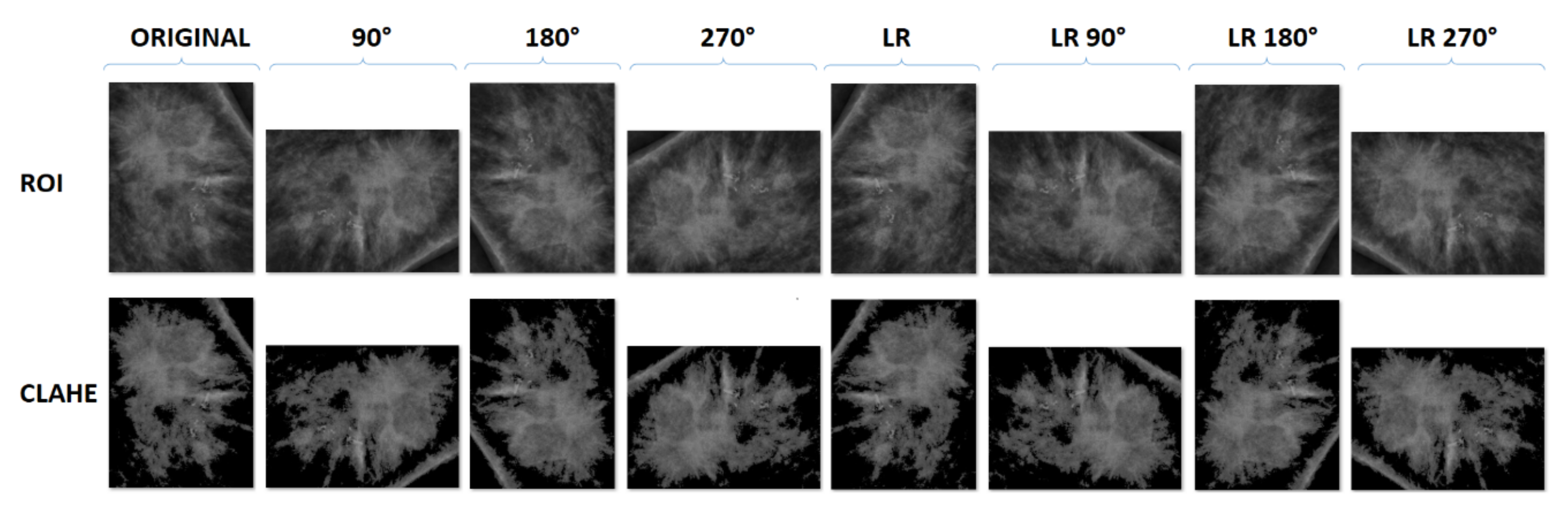 Classification of Breast Cancer in Mammograms with Deep Learning Adding ...