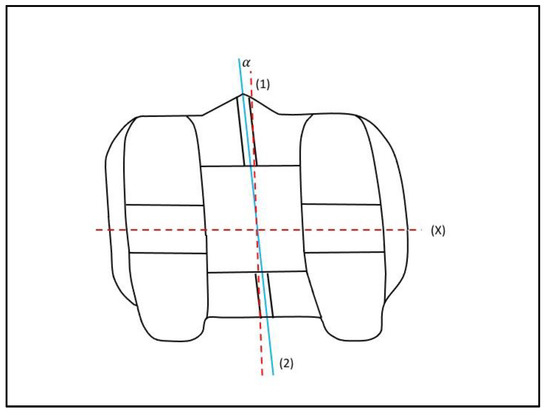 Tip and Torque Accuracy According to the ISO 27020:2019 Norm in ...