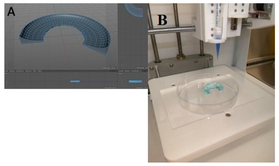 A 3D Bioprinted Human Meniscus Shape Enriched with Mesenchymal Cells