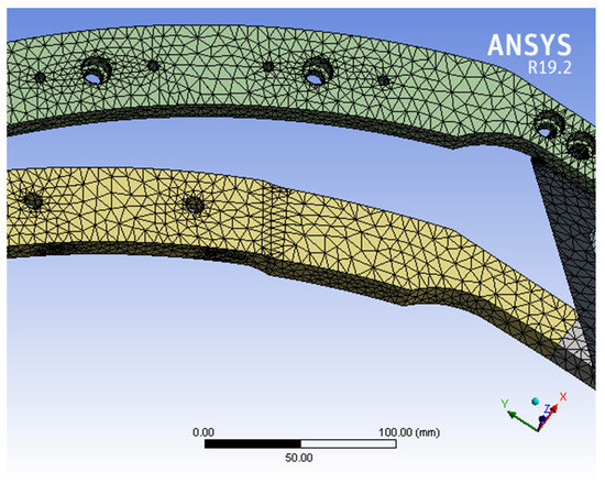 Dynamic Analysis of a Spherical Parallel Robot Used for Brachial ...