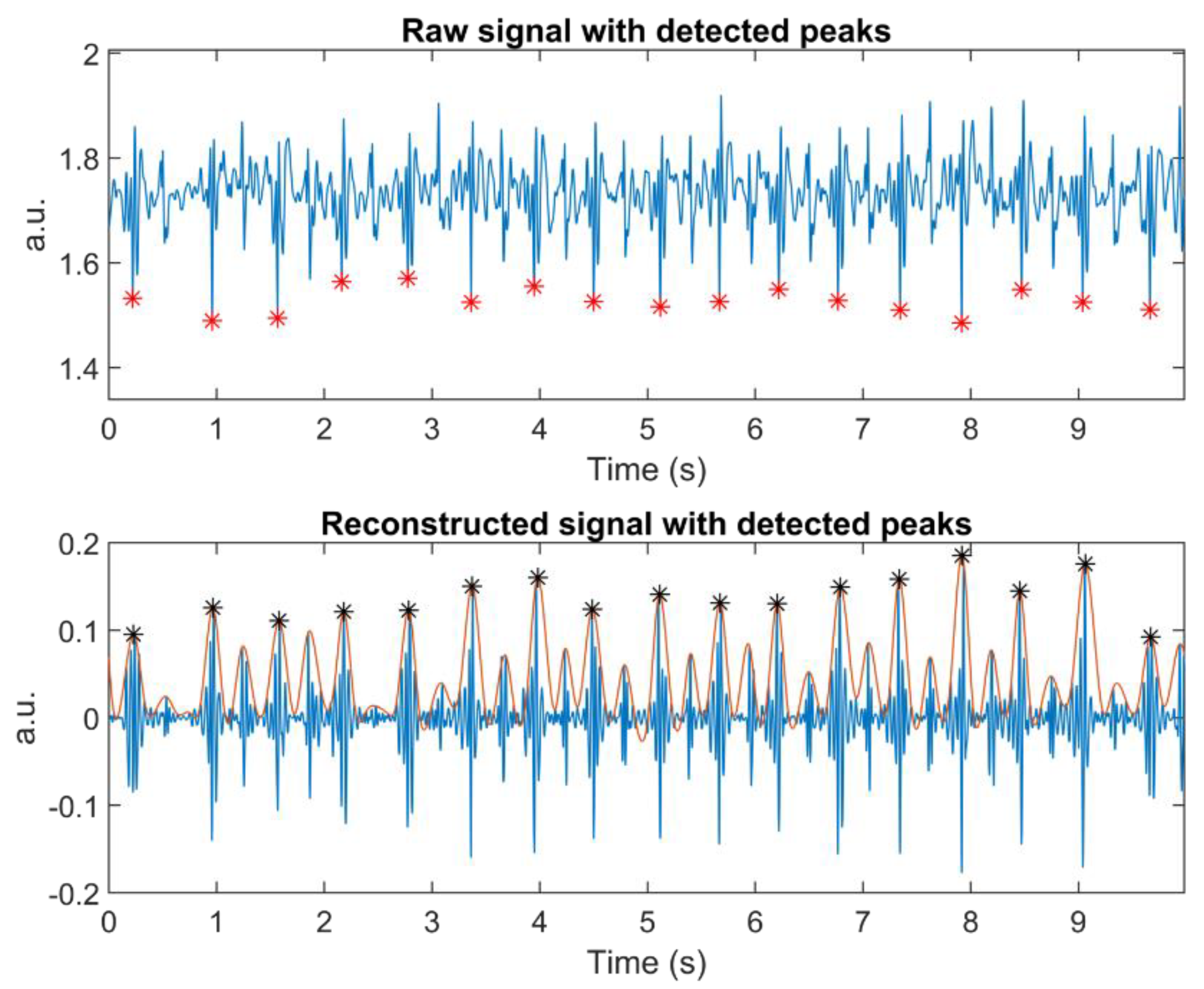 Applied Sciences Free Full Text Discrete Wavelet Transforms Based Analysis Of Accelerometer