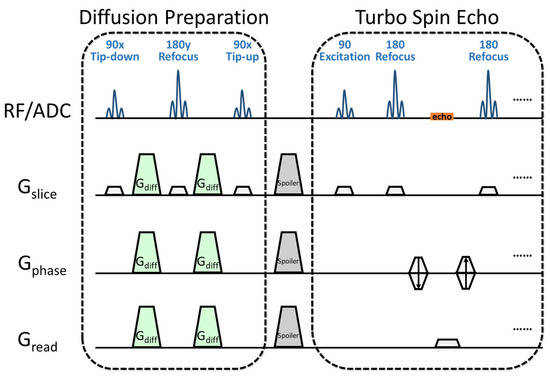 Diffusion-Weighted Imaging of the Macaque Brain Using Diffusion ...
