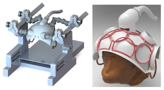 Diffusion-Weighted Imaging of the Macaque Brain Using Diffusion ...