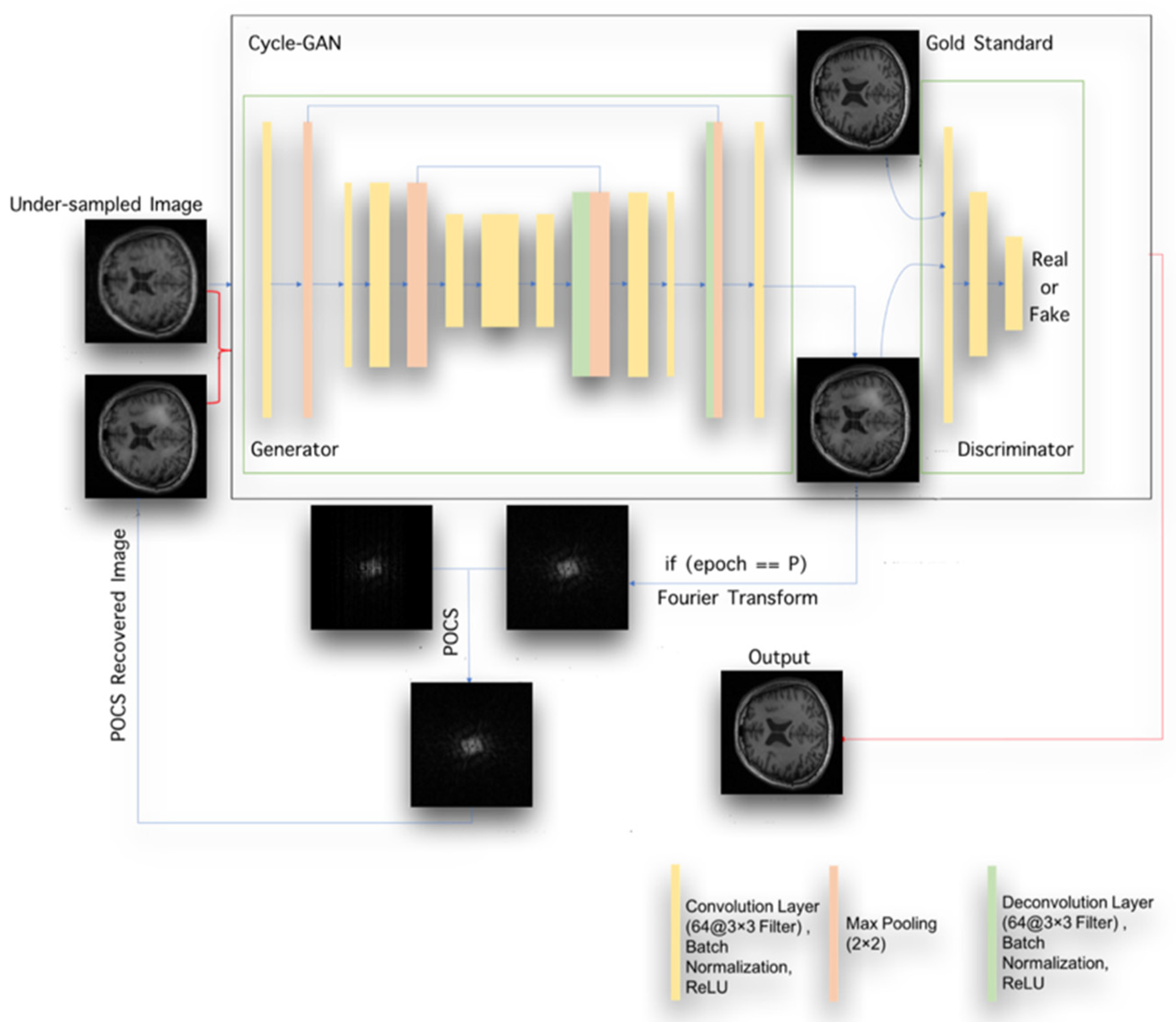Applied Sciences Free Full Text Pocs Augmented Cyclegan For Mr Image Reconstruction