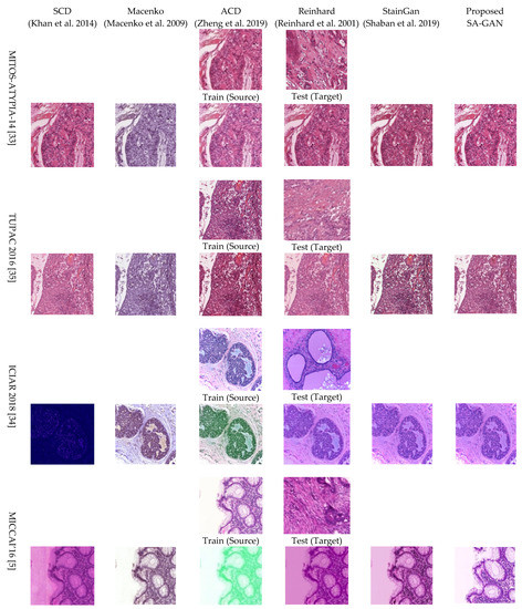 SA-GAN: Stain Acclimation Generative Adversarial Network for ...