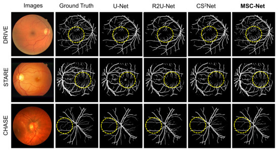 MSC-Net: Multitask Learning Network for Retinal Vessel Segmentation and Centerline Extraction