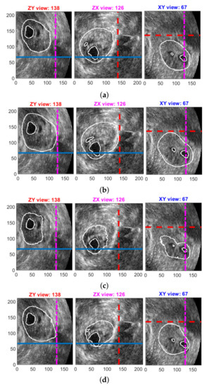 Applied Sciences Free Full Text Deeply Supervised 3d Convolutional