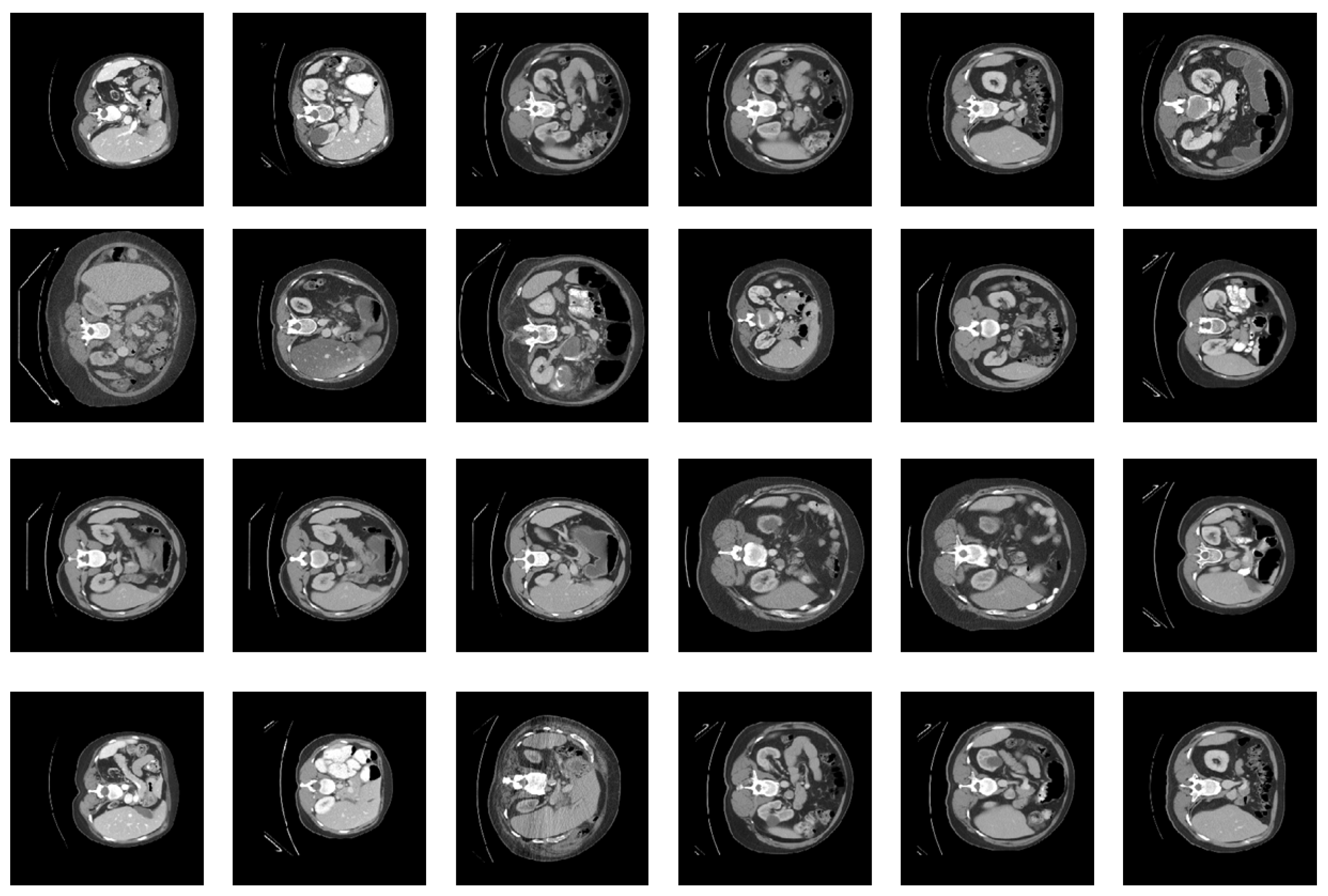 All You Need Is a Few Dots to Label CT Images for Organ Segmentation
