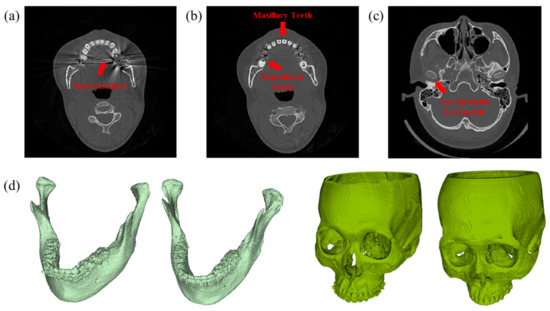 Applied Sciences | Free Full-Text | Deep Learning-Based Automatic Segmentation of Mandible and ...