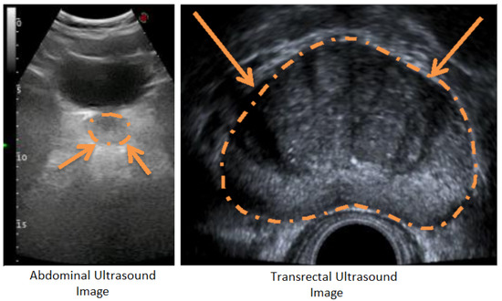 Applied Sciences Free Full Text Estimation Of The Prostate Volume
