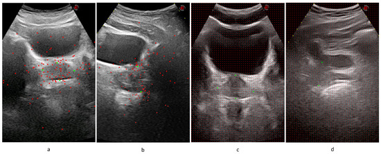 Estimation of the Prostate Volume from Abdominal Ultrasound Images by ...